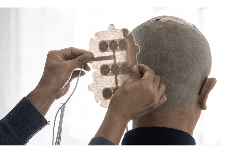 KEYNOTE D58 | Optune Gio HCP